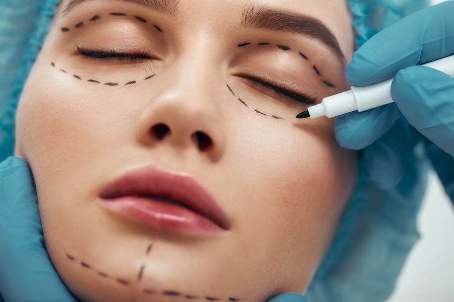 Double Eyelid Surgery: Understanding The Procedure And Considerations